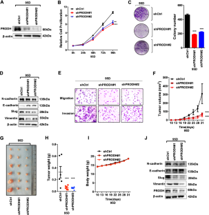 Cancer progression is mediated by proline catabolism in non-small cell ...