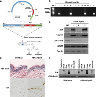 Overexpression of TC-PTP in murine epidermis attenuates skin tumor ...