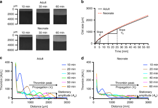 New insights into neonatal coagulation: normal clot formation despite ...