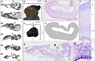 The fundamental building blocks of cortical development are established ...