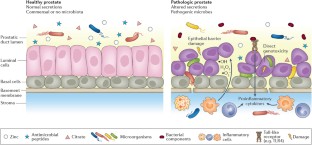 The microbiome in prostate inflammation and prostate cancer | Prostate ...