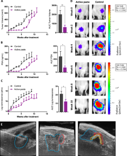 A polymeric paste-drug formulation for intratumoral treatment of ...