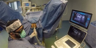 Transperineal laser ablation for percutaneous treatment of benign ...