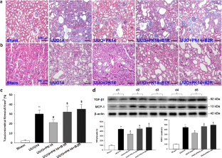 Exogenous pancreatic kininogenase protects against renal fibrosis in ...