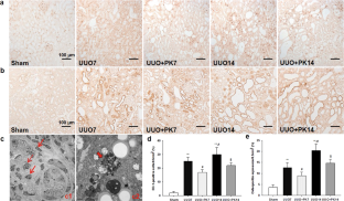 Exogenous pancreatic kininogenase protects against renal fibrosis in ...
