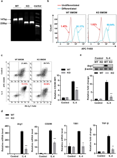 Sphingomyelin synthase 2 facilitates M2-like macrophage polarization ...