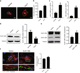 GJA1-20k attenuates Ang II-induced pathological cardiac hypertrophy by ...