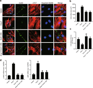 GJA1-20k attenuates Ang II-induced pathological cardiac hypertrophy by ...