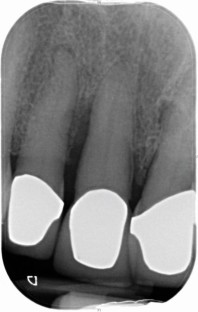Endodontic microsurgery. Part one: diagnosis, patient selection and ...