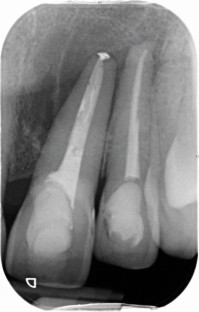 Endodontic microsurgery. Part one: diagnosis, patient selection and ...