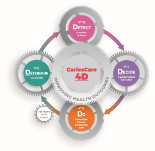CariesCare practice guide: consensus on evidence into practice ...