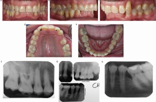 Initial periodontal therapy before referring a patient: an audit ...