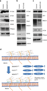 Global analysis of human glycosyltransferases reveals novel targets for ...
