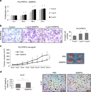 Mac-2-binding protein glycan isomer enhances the aggressiveness of ...