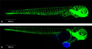 Modeling oncolytic virus dynamics in the tumor microenvironment using ...