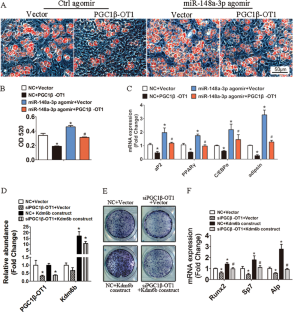 A novel long noncoding RNA PGC1β-OT1 regulates adipocyte and osteoblast ...