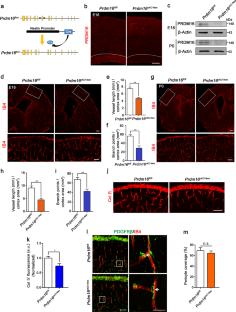 PRDM16 orchestrates angiogenesis via neural differentiation in the ...