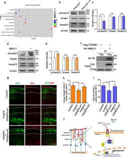 PRDM16 orchestrates angiogenesis via neural differentiation in the ...