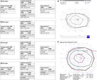 Accuracy of kinetic perimetry assessment with the Humphrey 850; an ...