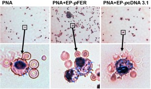 Electroporation-mediated delivery of FER gene enhances innate immune ...