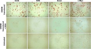 Regulatable adenovector harboring the GFP and Yamanaka genes for ...