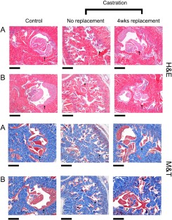 The effects of testosterone replacement on penile structure and ...