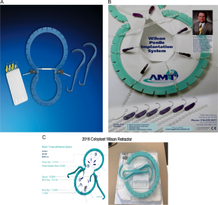 Penoscrotal approach for IPP: still up-to-date after more than 40 years ...