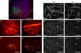 Next-generation in vivo optical imaging with short-wave infrared ...