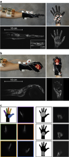 A high-impedance detector-array glove for magnetic resonance imaging of ...