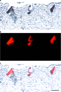 Rapidly separable microneedle patch for the sustained release of a ...