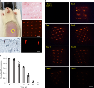 Rapidly separable microneedle patch for the sustained release of a ...