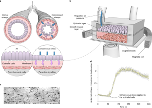 A microphysiological model of the bronchial airways reveals the ...