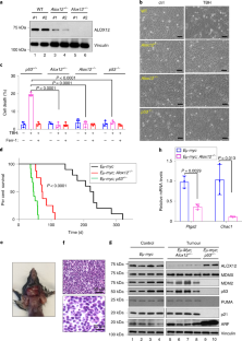 ALOX12 is required for p53-mediated tumour suppression through a ...