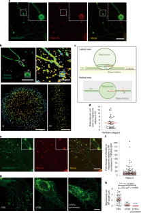 Migrasome formation is mediated by assembly of micron-scale tetraspanin ...