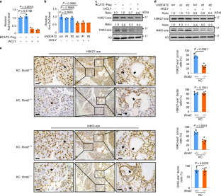 BCAT2-mediated BCAA catabolism is critical for development of ...