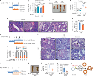 BCAT2-mediated BCAA catabolism is critical for development of ...