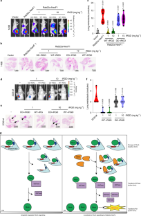 Chromosomal translocation-derived aberrant Rab22a drives metastasis of ...