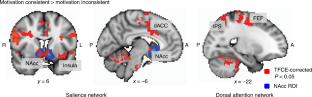 Neurocomputational mechanisms underlying motivated seeing | Nature ...