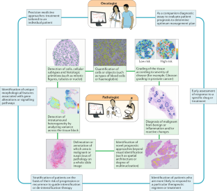 Artificial intelligence in digital pathology — new tools for diagnosis ...