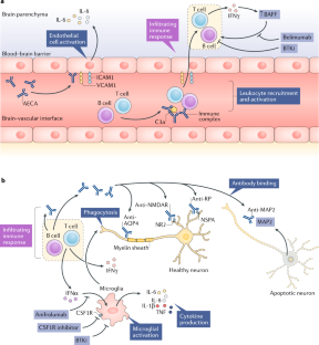 Neuropsychiatric lupus: new mechanistic insights and future treatment ...