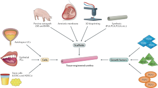 Regenerative and engineered options for urethroplasty | Nature Reviews ...