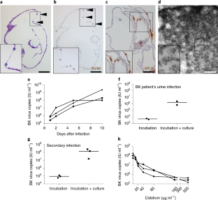 Tubuloids derived from human adult kidney and urine for personalized ...