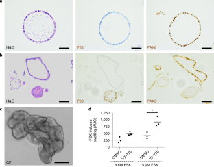 Tubuloids derived from human adult kidney and urine for personalized ...