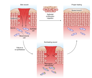 Wound, heal thyself | Nature Medicine