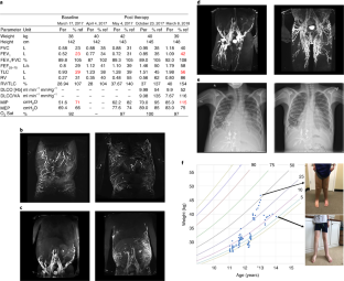 ARAF recurrent mutation causes central conducting lymphatic anomaly ...