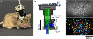 All the light that we can see: a new era in miniaturized microscopy ...