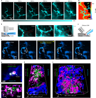 Light-sheet microscopy in the near-infrared II window | Nature Methods