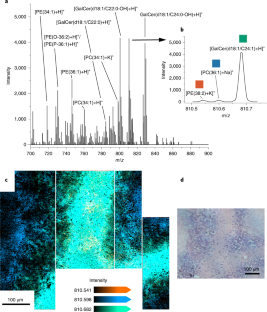 Transmission-mode MALDI-2 mass spectrometry imaging of cells and ...