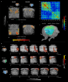 4D functional ultrasound imaging of whole-brain activity in rodents | Nature Methods