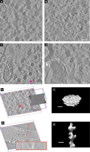 Lewy pathology in Parkinson’s disease consists of crowded organelles ...